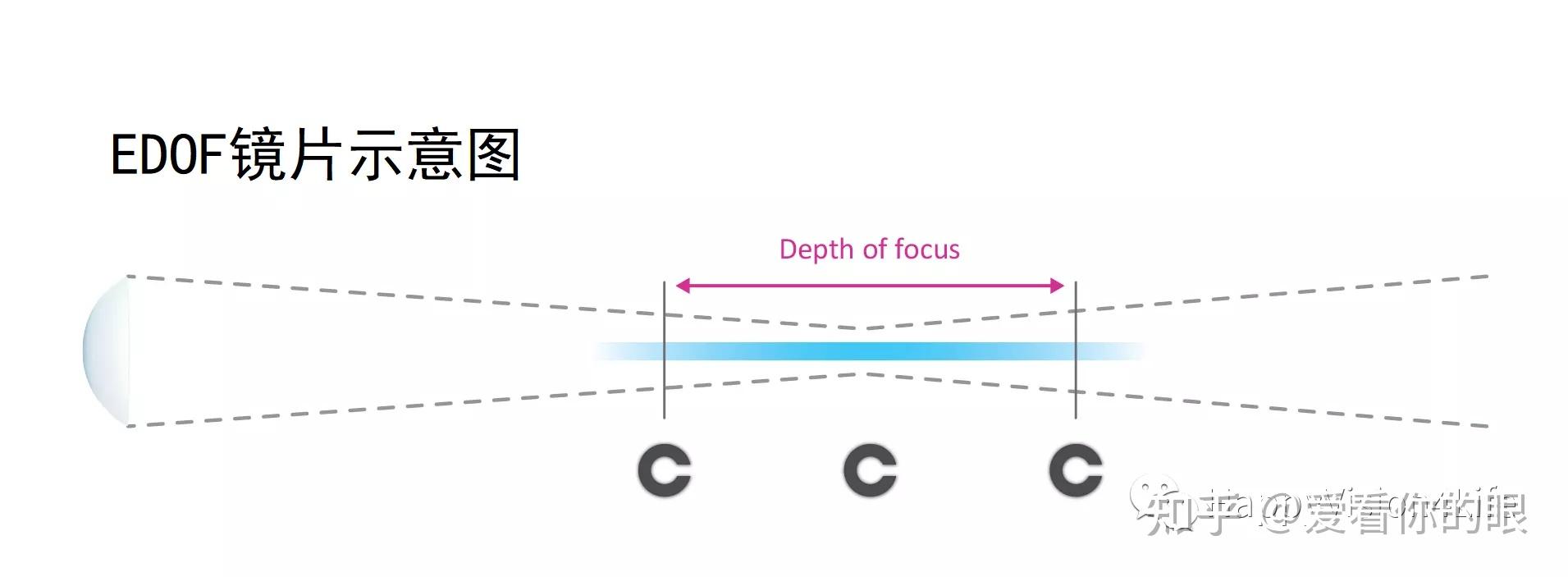 近视防控的新方案:EDOF软镜 - 知乎