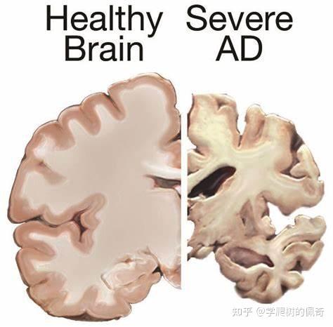 NHANES数据库练手DAY2（死亡笔记） - 知乎