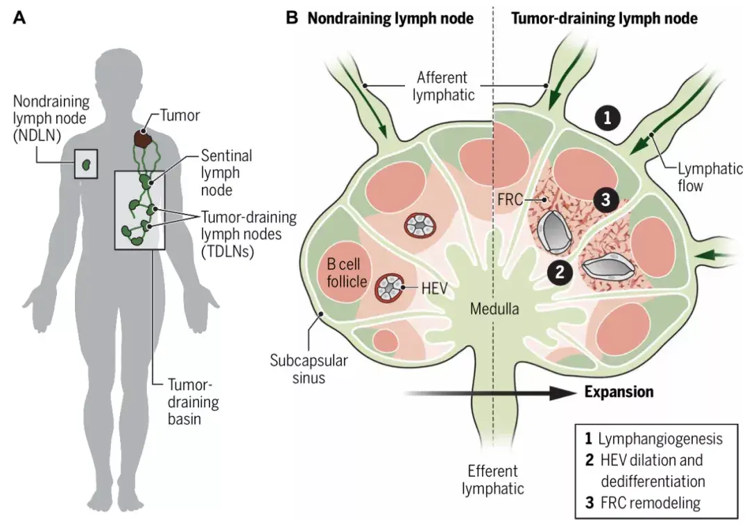 Sci Immu | 肿瘤引流淋巴结，肿瘤发展的罪魁祸首，还是治疗干预的重要机会？ - 知乎