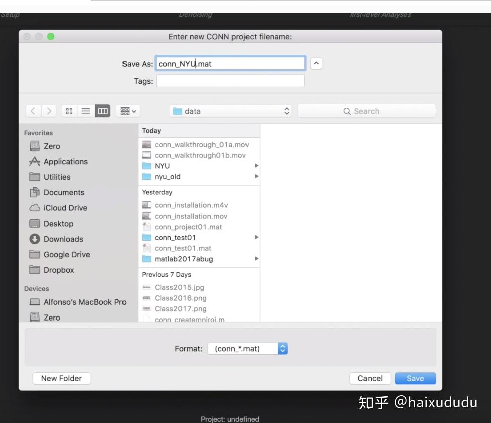 CONN使用总结1 (resting-state fMRI) - 知乎