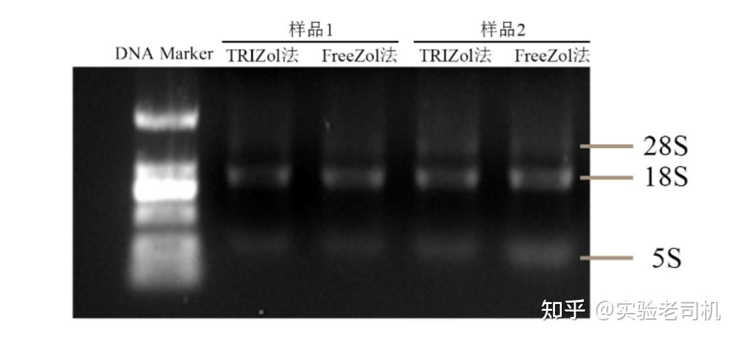 手把手教学——RNA提取的实验步骤&注意事项 - 知乎