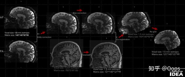 EPI distortion correction形变矫正 - 知乎