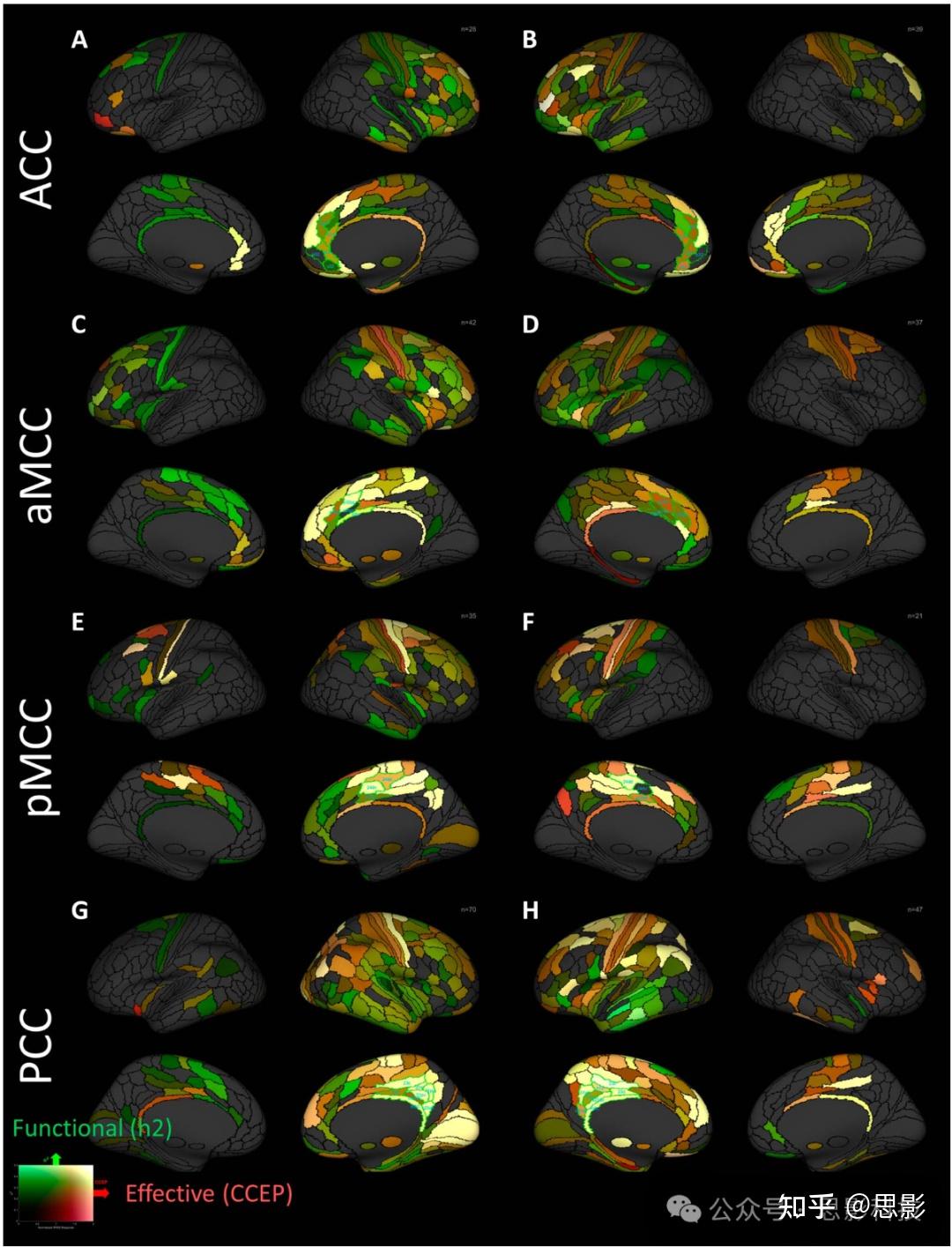 扣带皮层：解剖、结构与功能连通性 - 知乎