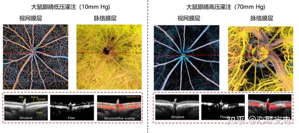动物光学相干断层扫描血管成像系统 - 知乎