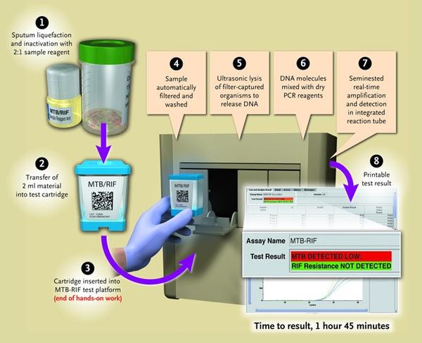 Cepheid公司的GeneXpert芯片检测流程 - 知乎