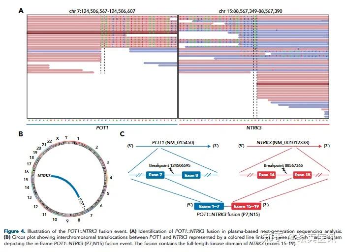 NSCLC耐药坎坷之路—EGFR T790M/C797S顺式+反式、MET扩增、NTRK3融合，获益三靶联合 - 知乎