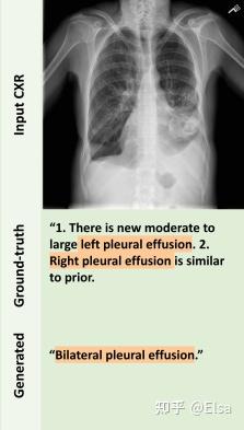 论文解读：LLM-CXR 采用instruction-finetuning提升多模态大模型在医疗影像诊断的效果 - 知乎