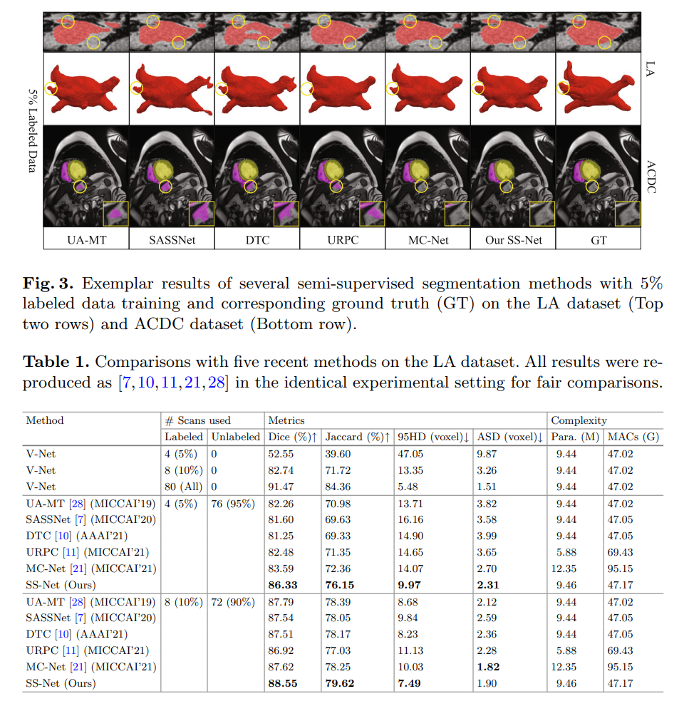 MICCAI 2022 | 半监督医学图像分割的平滑性和类分离研究 - 知乎