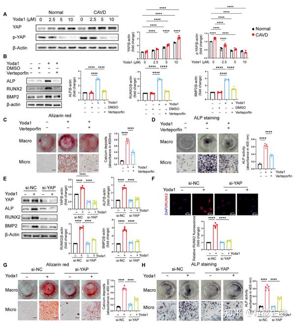 Piezo1的激活通过YAP依赖的谷氨酰胺水解促进主动脉瓣间质细胞的成骨分化 - 知乎