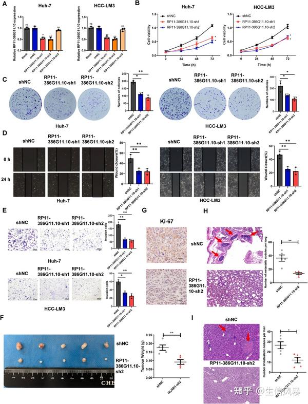 8+新型促癌lncRNA的生信思路 - 知乎