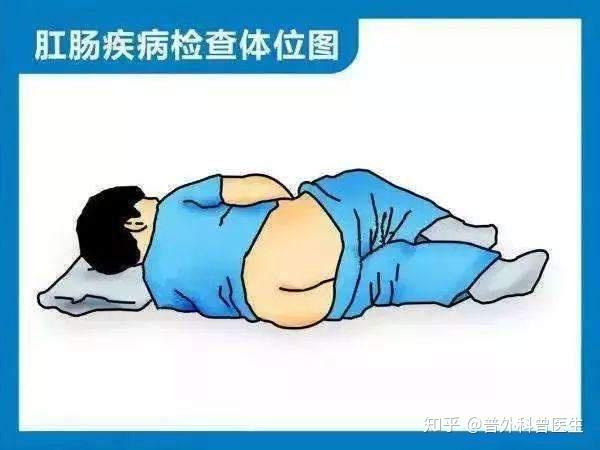 直肠指检到底疼不疼，哪些人需要做，医生告诉你答案 知乎