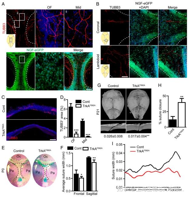 诺奖热点 | 空间转录组学揭示感觉神经通过调节BMP/TGF-β信号通路在保持颅缝通畅中的作用 - 知乎