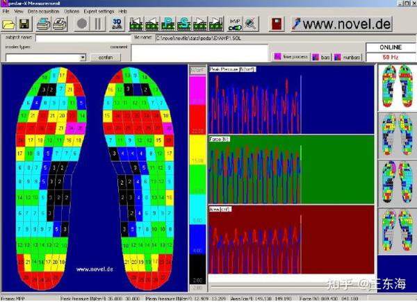 足底压力分布测量系统介绍 - 知乎
