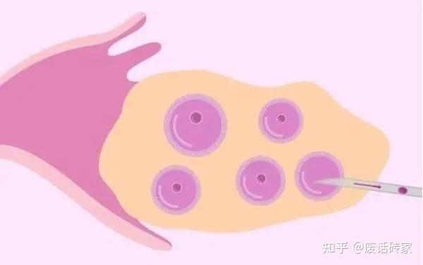 贝安健康:基础卵泡数量与年龄有何关系 知乎