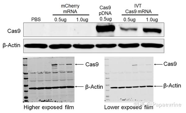 选择性器官靶向（SORT）纳米粒子用于组织特异性mRNA递送和CRISPR/Cas基因编辑（2021.09.07） - 知乎