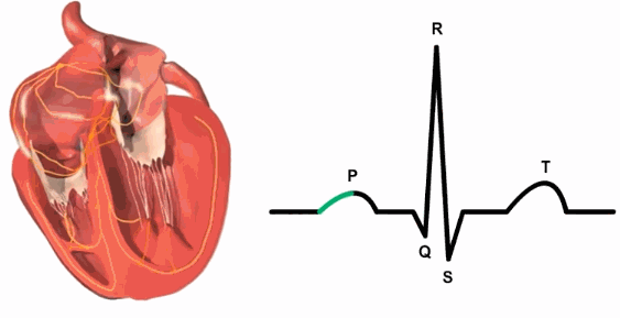 深度医疗(1) - 基于深度学习心电图(ECG)特征识别 - 知乎