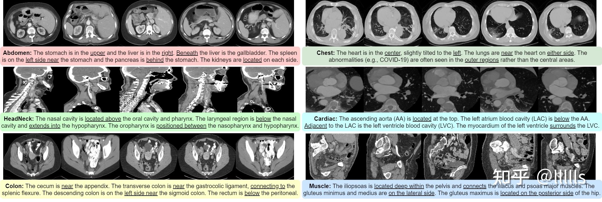 Large-Scale Medical 大规模医学视觉预训练 - 知乎