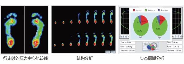 步态分析仪的工作原理 - 知乎