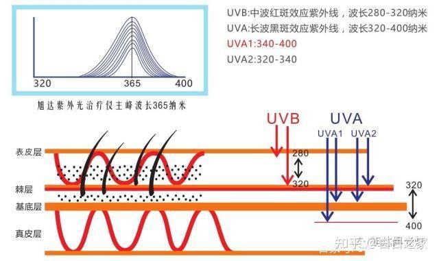白癜风治疗仪知识4-UVA1适应证分类为哪些？ - 知乎