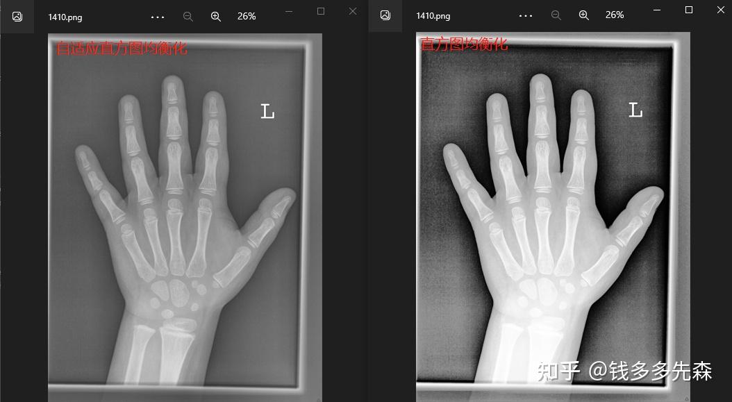 图像处理笔记2 直方图与直方图均衡化histogram Equalization 知乎