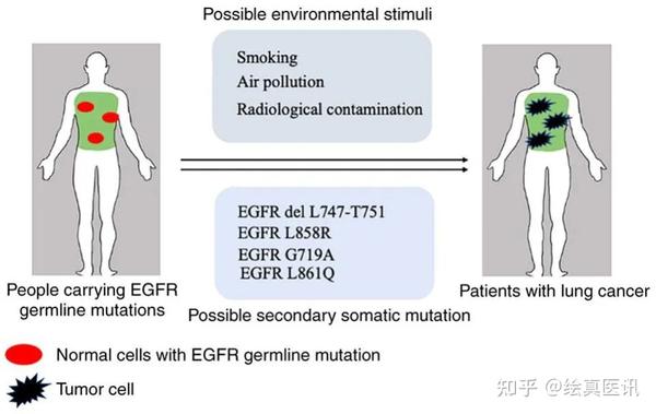 肺癌也会遗传！EGFR常见胚系突变最全汇总 - 知乎