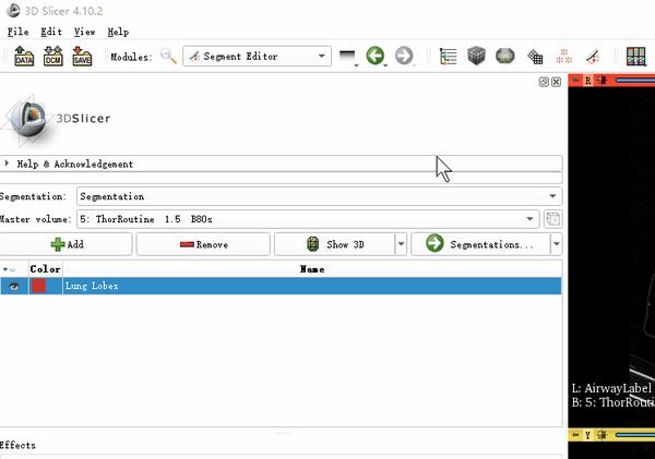 用3D Slicer来实现肺部密度分析可视化 - 知乎