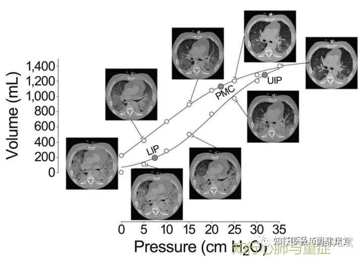 第149期 滴定PEEP的9个方法 - 知乎