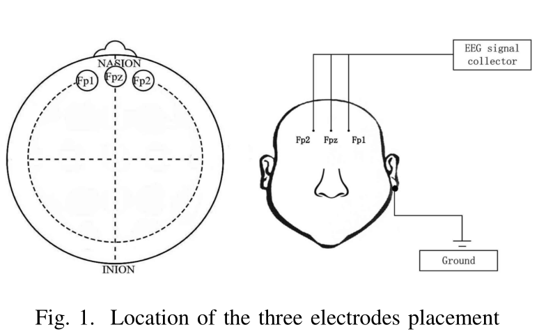 《Depression Detection from Electroencephalogram Signals Induced by ...