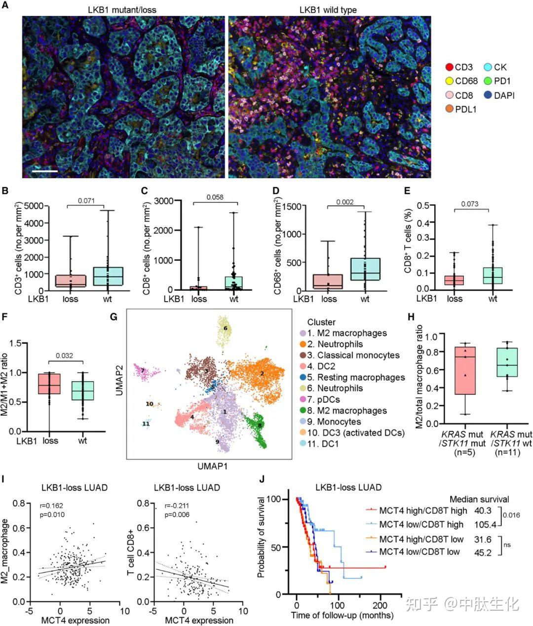 《癌细胞》：肿瘤“酸倒”T细胞！最新研究揭示，STK11突变型肺癌中的乳酸可抑制抗肿瘤免疫应答 - 知乎