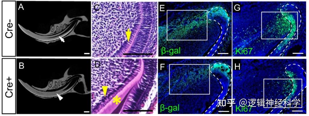 Nat Commun︱南加州大学柴洋课题组揭示感受神经通过FGF/mTOR/autophagy信号轴调控间充质干细胞稳态 - 知乎