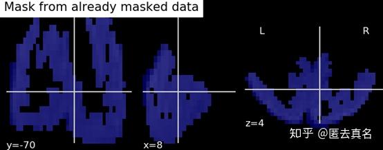 Nilearn：基于Python语言神经成像的机器学习（7） - 知乎