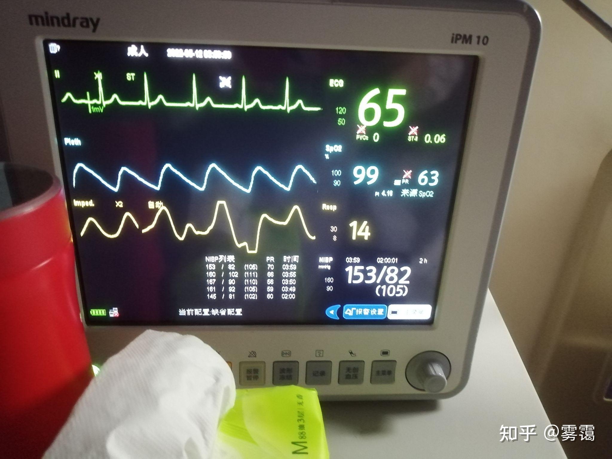 我想问一下有哪些老人是因为乱吃药导致心脏病 知乎