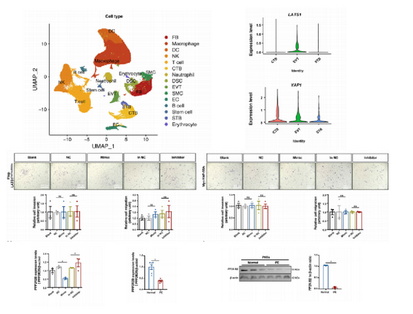 项目文章 | miR21通过干扰PP2A Bβ来调节Hippo信号通路引起子痫前期 - 知乎