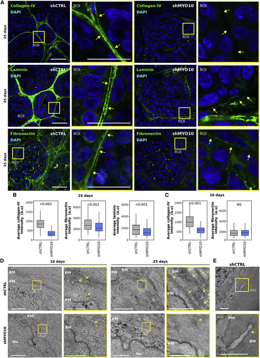 Developmental Cell | MYO10-丝足支持侵袭前肿瘤边界基底膜 - 知乎