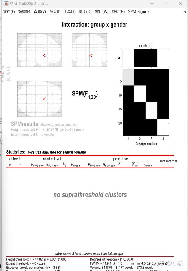 13-SPM-fmri任务态 二阶分析：多因素方差分析 - 知乎