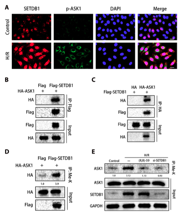 国产顶刊Research丨肝细胞 SETDB1 通过靶向 ASK1 信号的赖氨酸甲基化调控肝缺血再灌注损伤 - 知乎