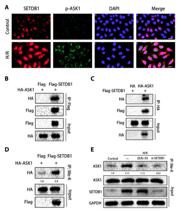 国产顶刊Research丨肝细胞 SETDB1 通过靶向 ASK1 信号的赖氨酸甲基化调控肝缺血再灌注损伤 - 知乎