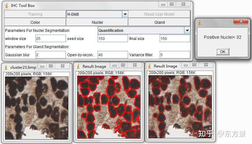 ImageJ | 免疫组织化学（IHC）图像分析工具箱 | 下载地址 | 安装教程 | 使用教程 - 知乎