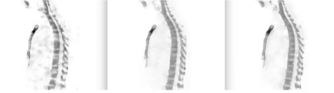 临床案例——RaDynMR、RaDynPET、RaDynCT、RaDynSPECT - 知乎