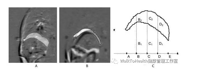 99%的腰痛人群都存在的问题——呼吸。 - 知乎