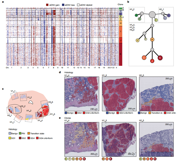Nature | 利用空间转录组解析良、恶性组织的拷贝数变异 - 知乎