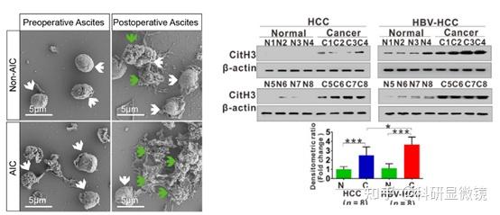 通过多篇10+高分文献结果揭示国自然热点中性粒细胞胞外诱捕网（NETs）相关实验 - 知乎