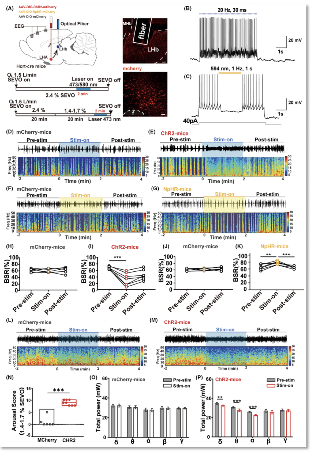 睡眠分析 | Lunion Stage® 功能更新：增加爆发抑制率指标计算功能 - 知乎