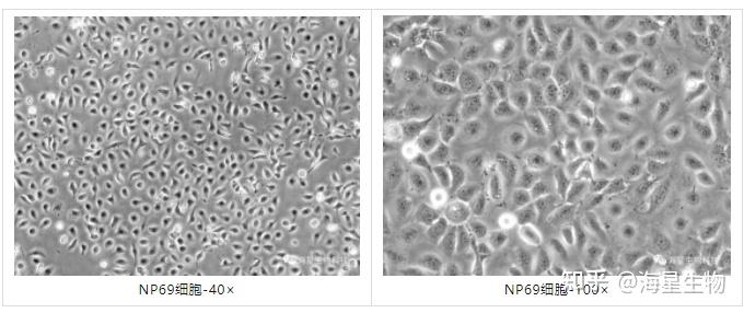 人鼻咽上皮细胞(NP69)培养常见问题及解决办法 - 知乎