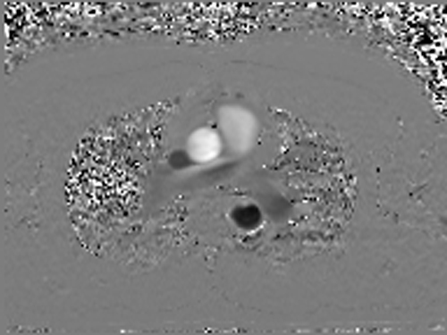 PC-MRA是如何工作的？ - 知乎