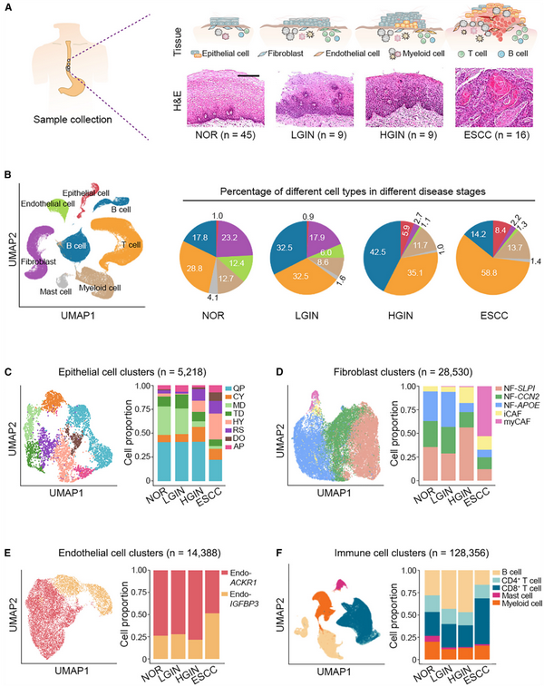 Cancer Cell新文章：食管癌发展过程中细胞类型转化的分子机制 - 知乎