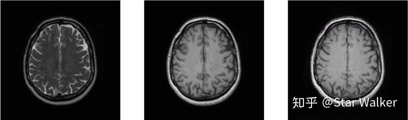跟着RSNA大神一起来，MRI T2秒变T1