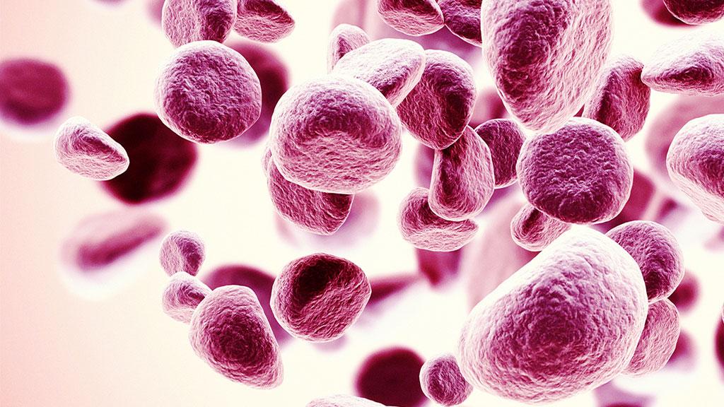 慢性免疫性血小板减少症新治疗选择！NICE推荐fostamatinib用于TPO-RA药物无效后 - 知乎