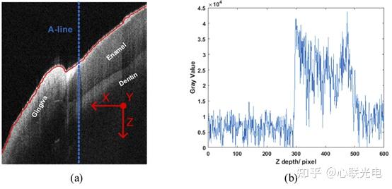 在3D-OCT图像中使用半自动配准和分割对牙龈组织体积进行测量 - 知乎
