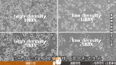 SK-BR-3细胞培养，人乳腺癌细胞培养攻略-丰晖生物 - 知乎